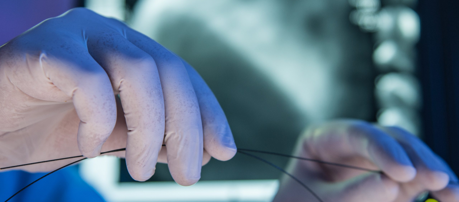 Blog - American Vascular Associates